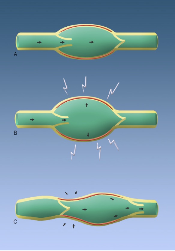 Beyond the basics - What is the Lymphatic System? - Jennifer Blenkinsop